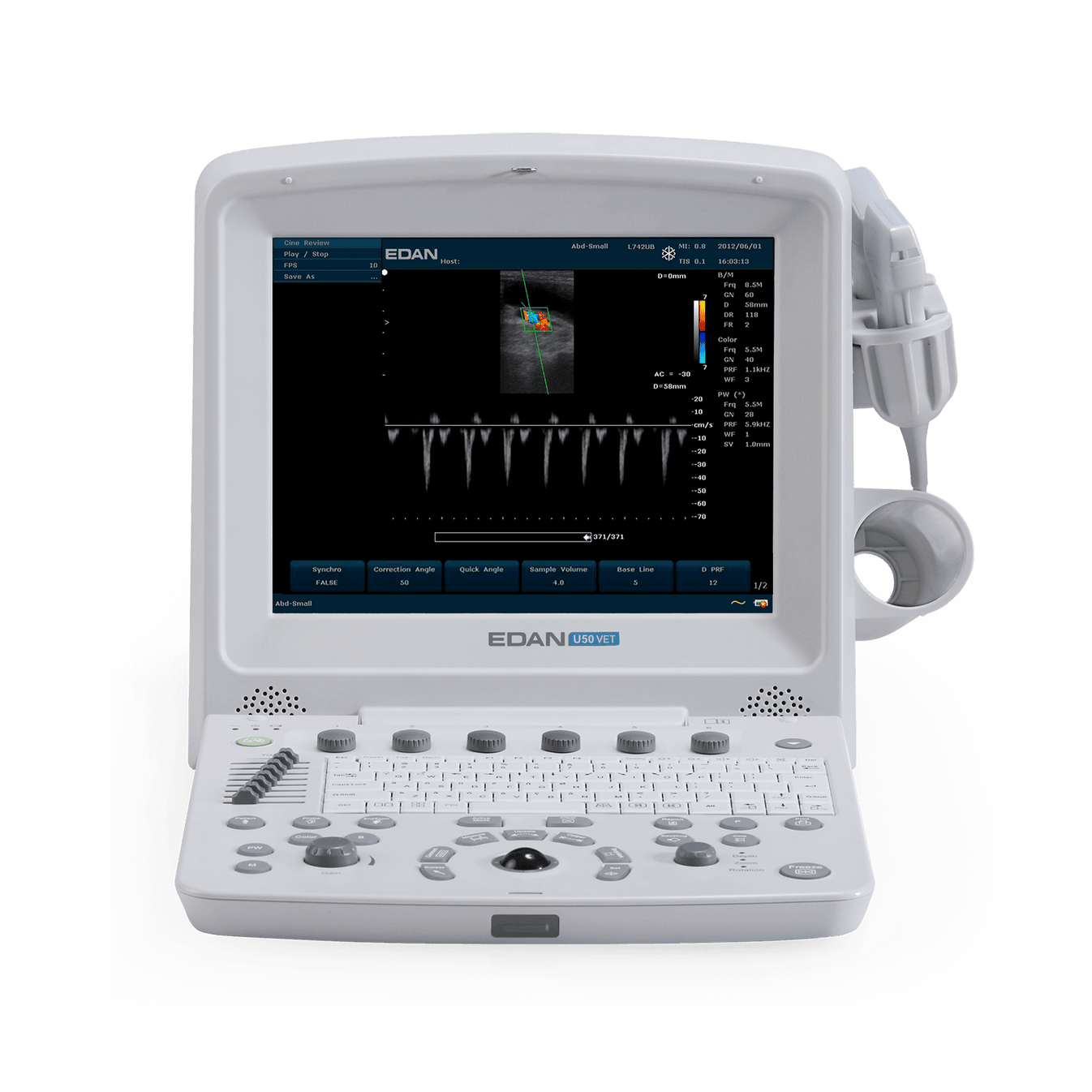 Ecógrafo Veterinario Edan U50 VET – Global Ultrasonido