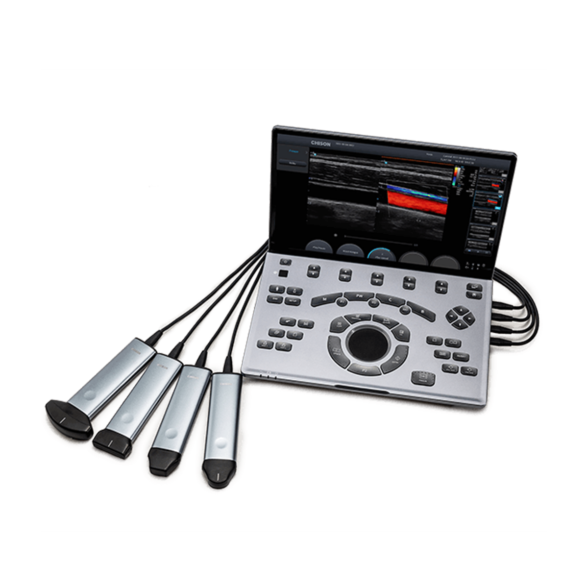 Ecógrafo Chison SonoAir 70 – Global Ultrasonido