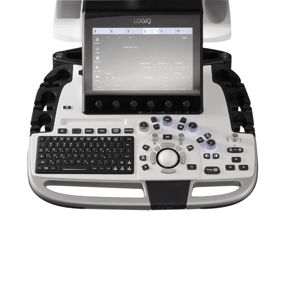 Ecógrafo General Electric LOGIQ E10 – Global Ultrasonido