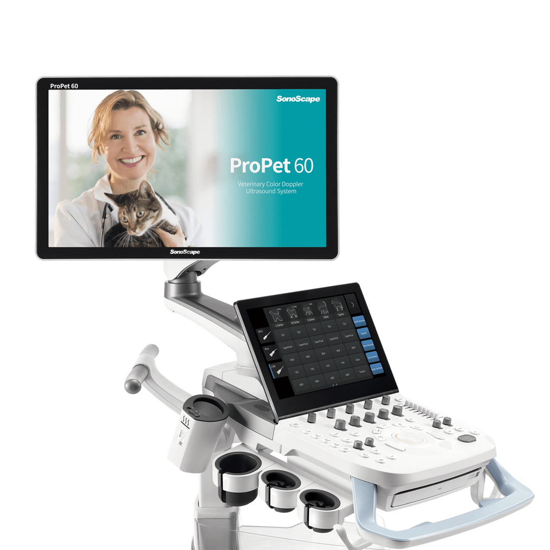 Ecógrafos SonoScape – Global Ultrasonido