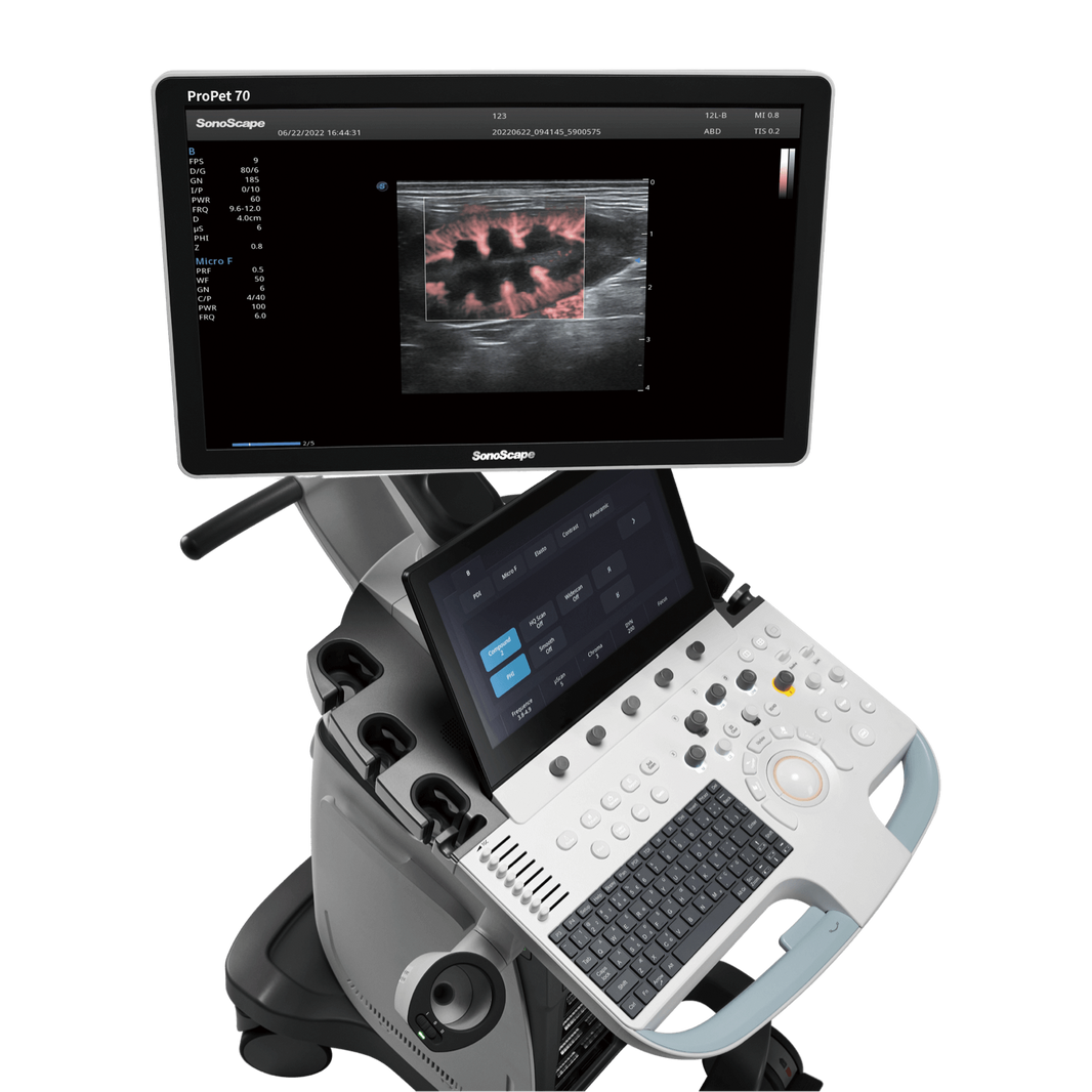 Ecógrafos SonoScape – Global Ultrasonido