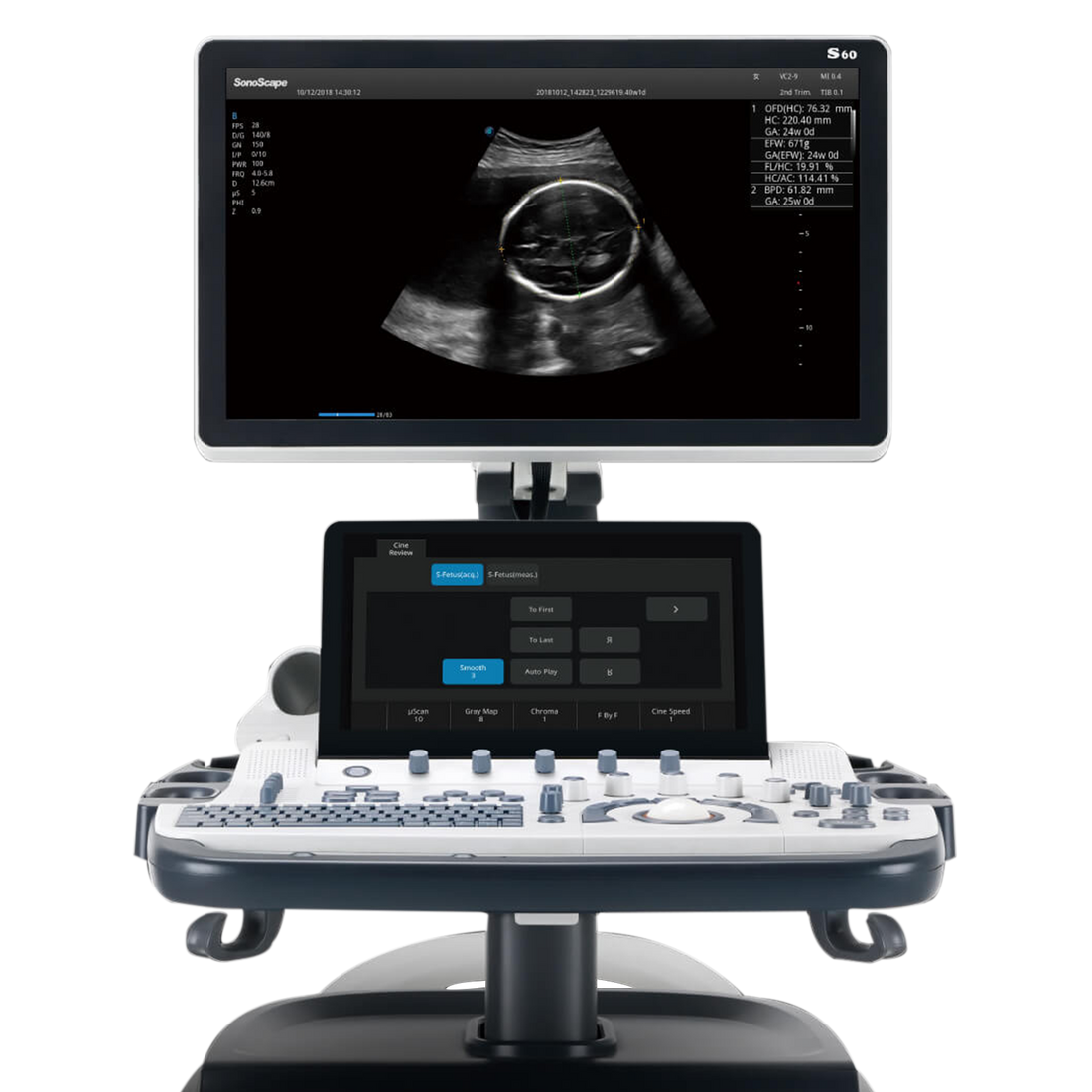 Ecógrafo SonoScape S60 – Global Ultrasonido