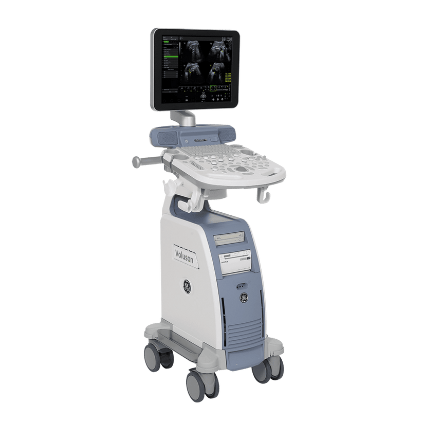 Ecógrafo General Electric Voluson P8 – Global Ultrasonido