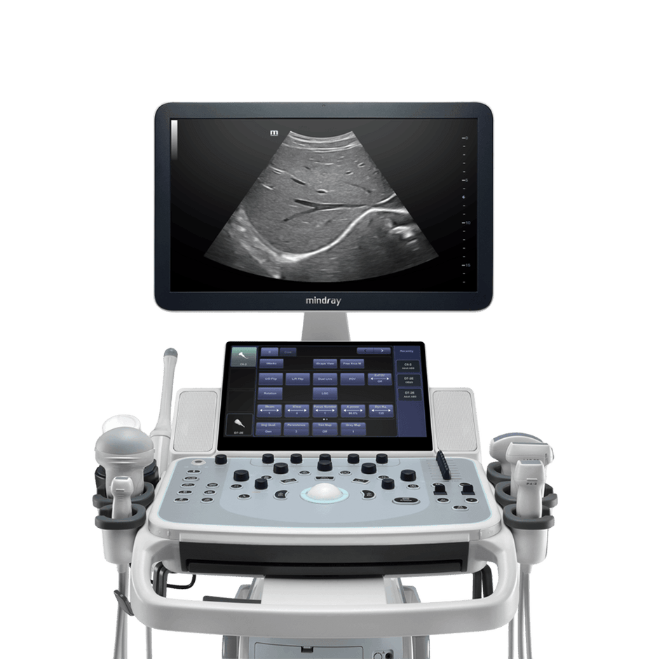 Mindray – Global Ultrasonido