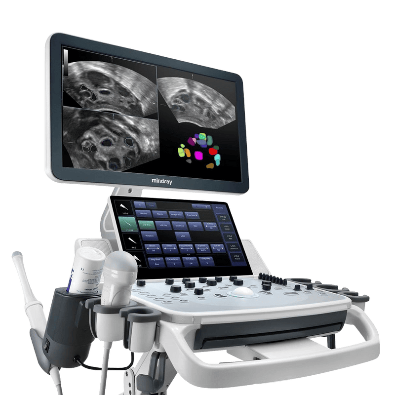 Ecógrafo Mindray DC-60 – Global Ultrasonido