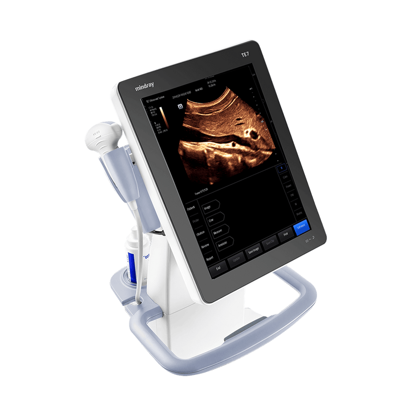 Ecógrafo Mindray TE7 – Global Ultrasonido