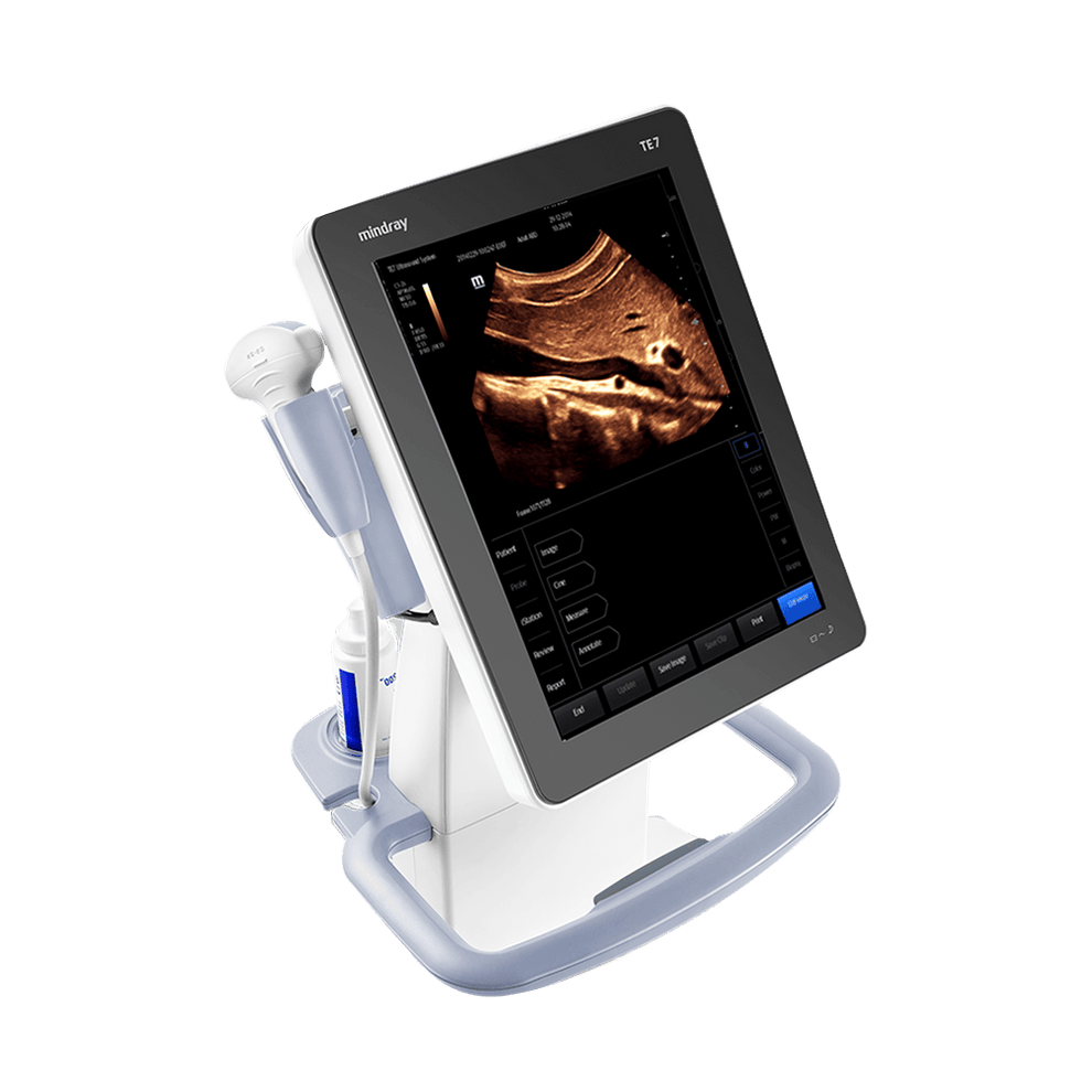 Ecógrafo Mindray TE7 – Global Ultrasonido