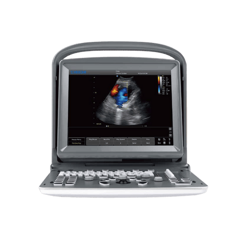 Ecógrafo Chison ECO 5 – Global Ultrasonido