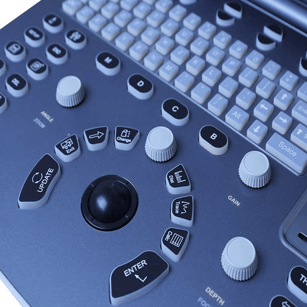 Ecógrafo Chison ECO 5 – Global Ultrasonido