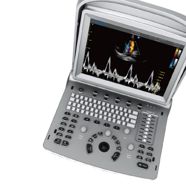 Ecógrafo Chison ECO 6 – Global Ultrasonido