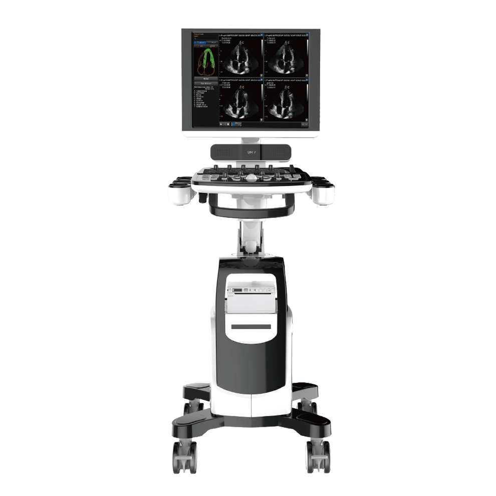 Ecógrafo Chison QBit 7 – Global Ultrasonido