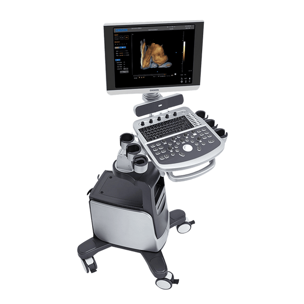 Ecógrafo Chison QBit 7 – Global Ultrasonido