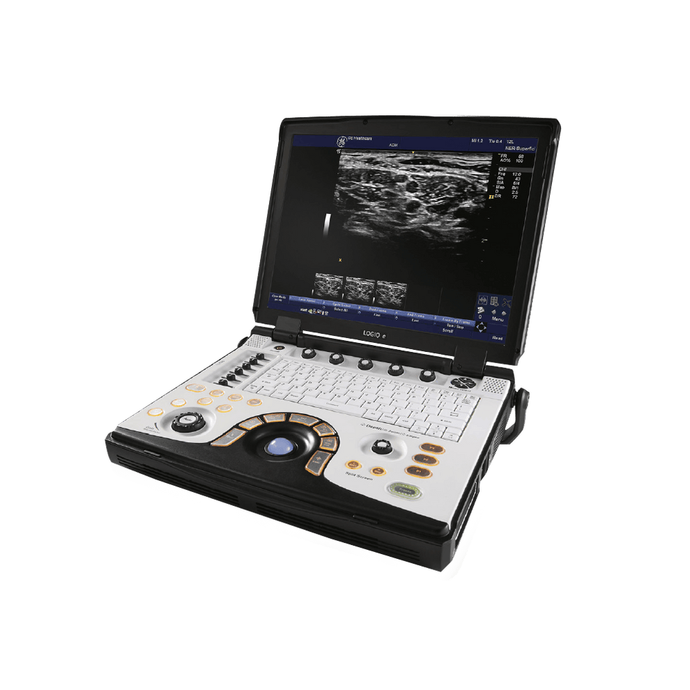 Ecógrafo General Electric LOGIQ ER7 – Global Ultrasonido